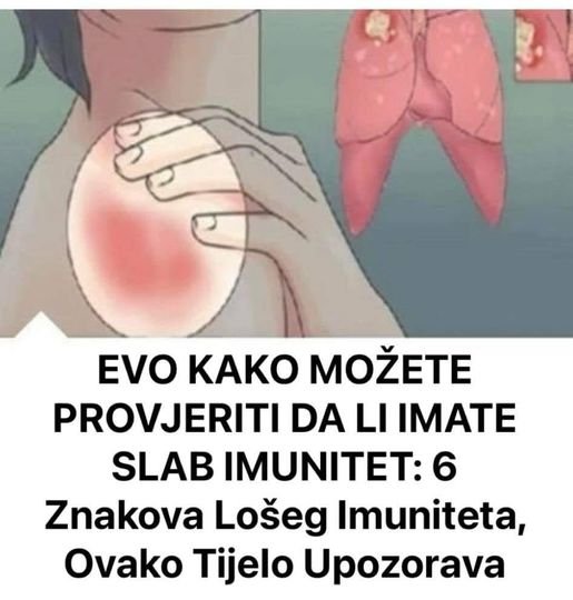 EVO KAKO MOŽETE PROVJERITI DA LI IMATE SLAB IMUNITET: 6 Znakova Lošeg ...