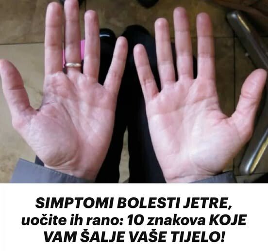 SIMPTOMI BOLESTI JETRE, uočite ih rano: 10 znakova KOJE VAM ŠALJE VAŠE ...