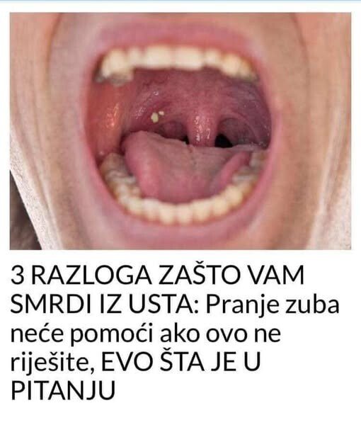 OVO SU 3 RAZLOGA ZAŠTO VAM SMRDI IZ USTA: Pranje zuba neće pomoći ako ...