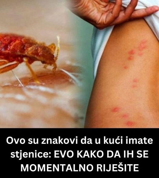 Ovo su znakovi da u kući imate stjenice: EVO KAKO DA IH SE MOMENTALNO ...
